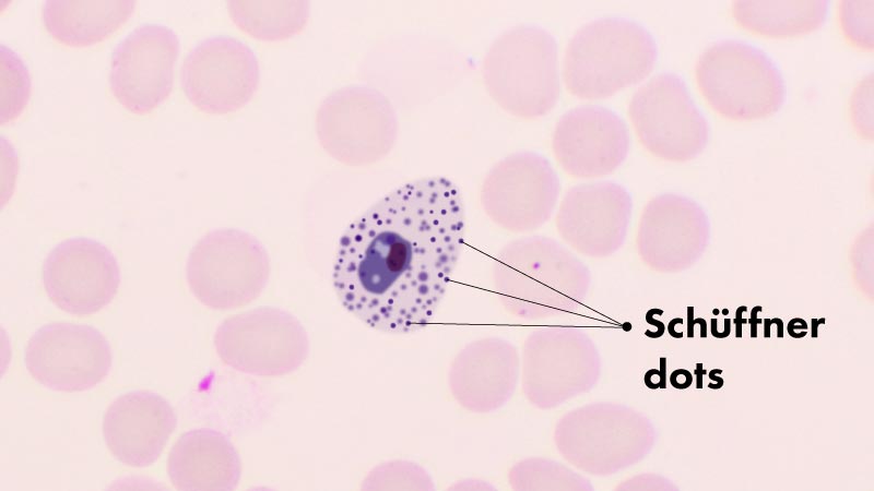 Plasmodium Vivax Vs Ovale